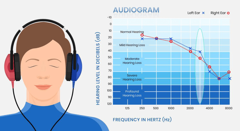 Digital Signal Processing for Over-The-Counter Hearing Aids | audioXpress