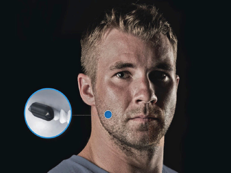 Sonitus Technologies Extends Molar Mic Two-Way Comms Platform and Bone ...